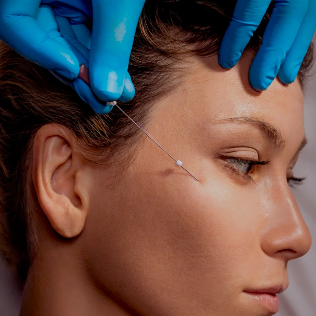 Fios de PDO - BeautyCode